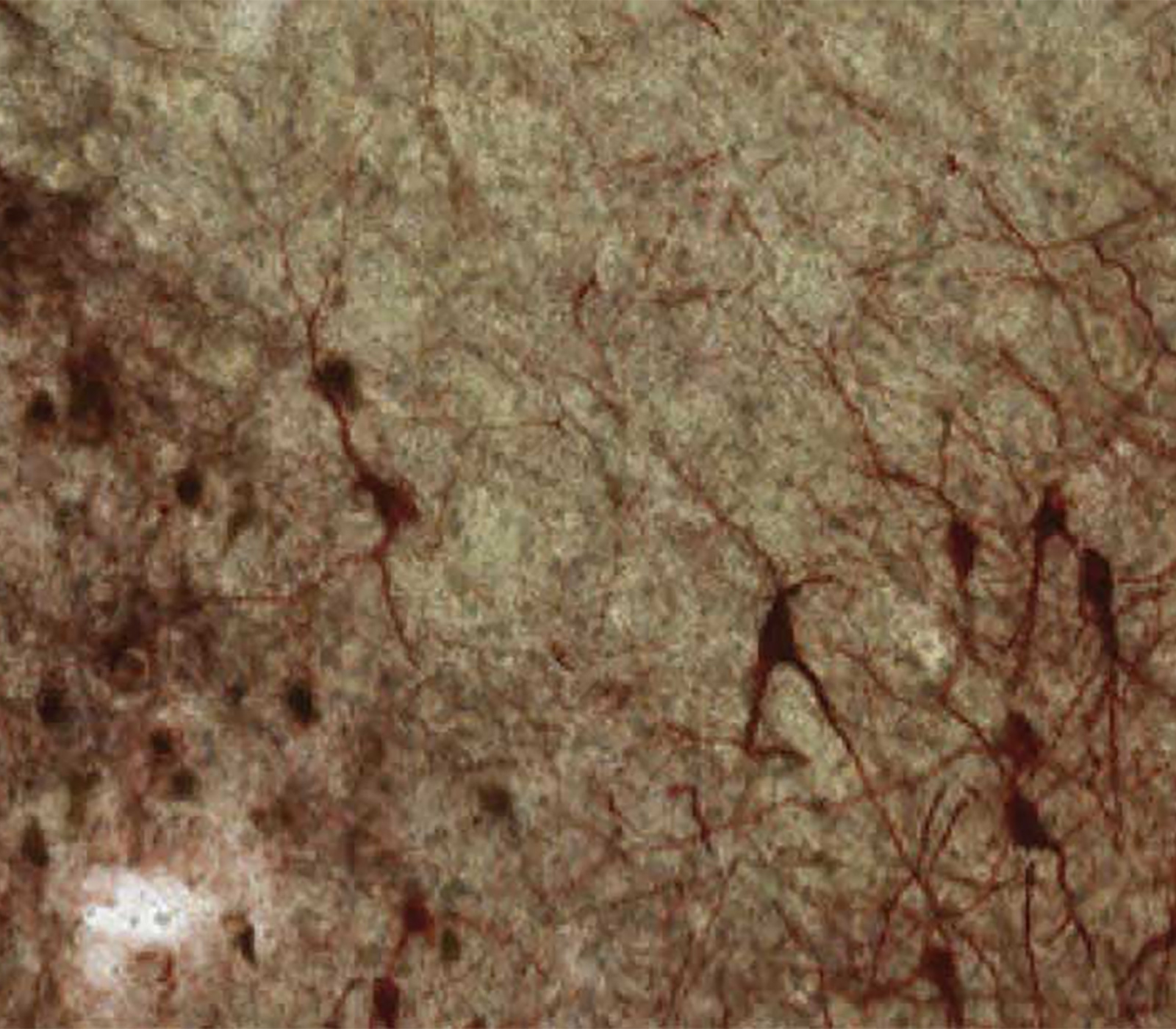 Three-color IHC Staining On Free-floating Sections From Human Brain - Enzo