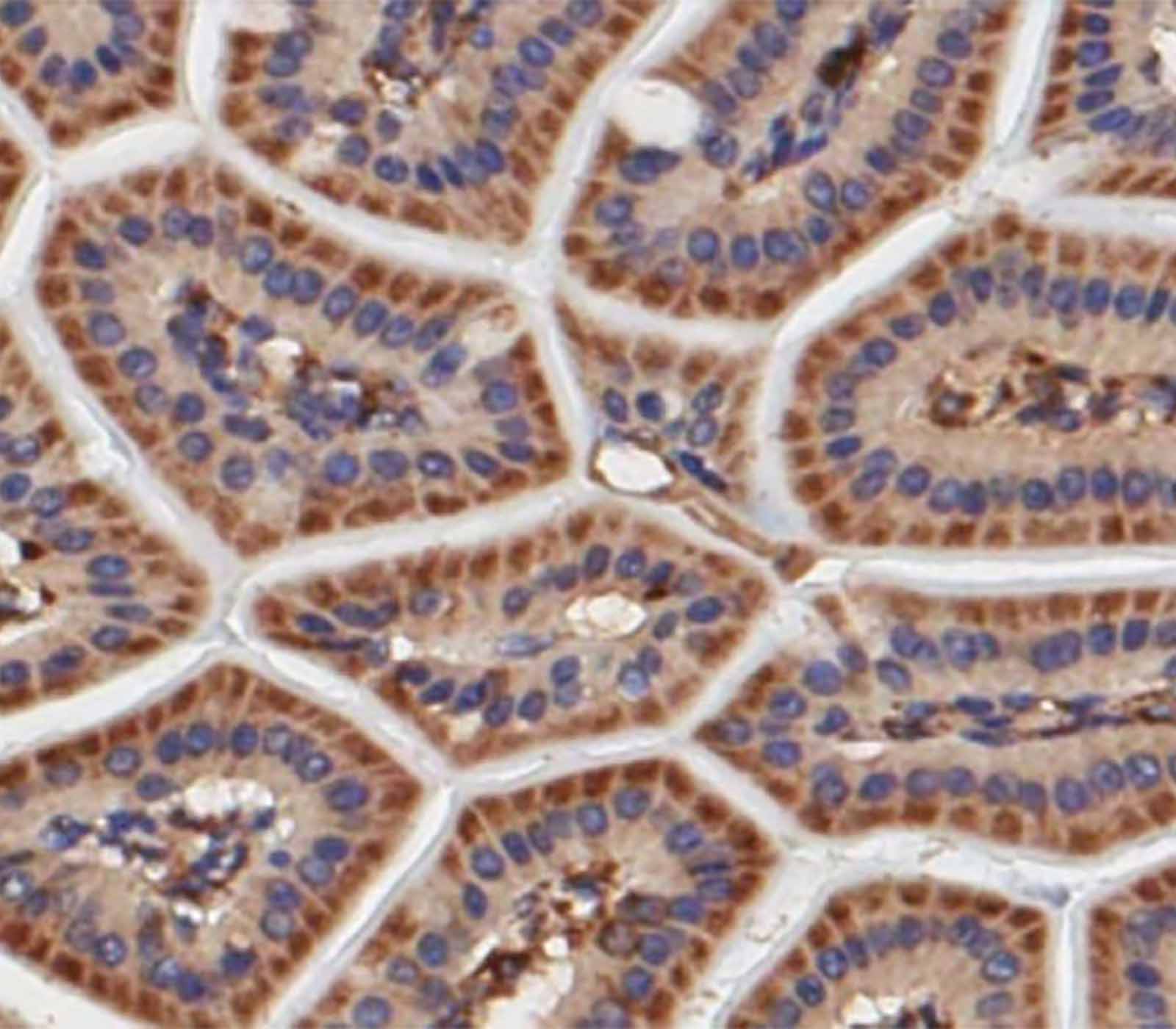Using Mouse-on-Mouse IHC Kits In Various Sample Types - Enzo