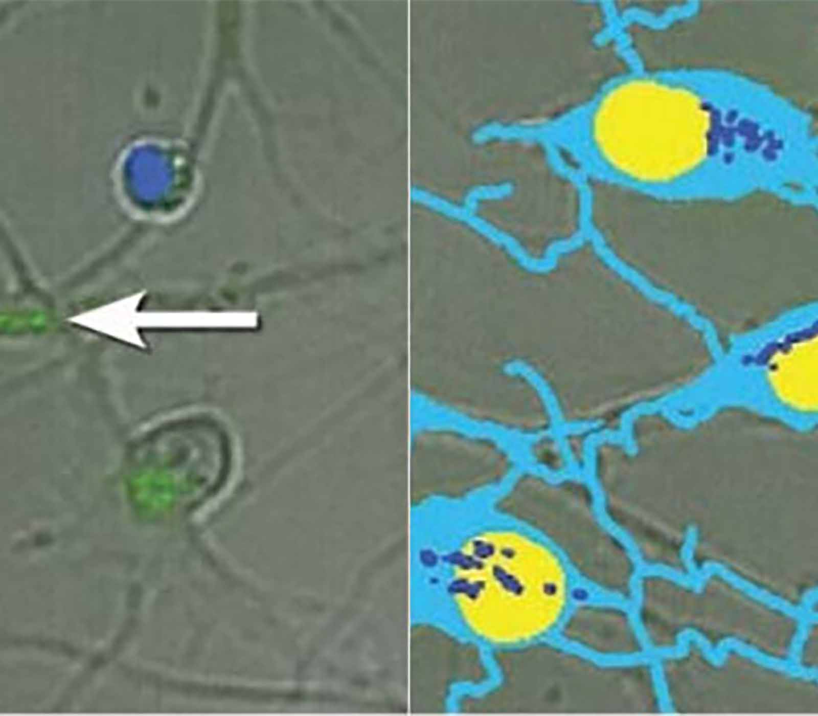 Visualizing subcellular vesicles to quantitate autophagy in neuronal ...