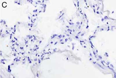 AMPIVIEW® RNA probes - Enzo