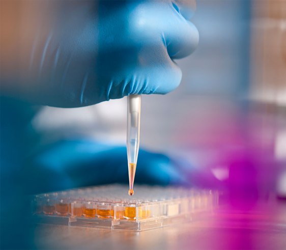 Dilutional Linearity, Parallelism, Spike-and-Recovery in ELISA: How to ...