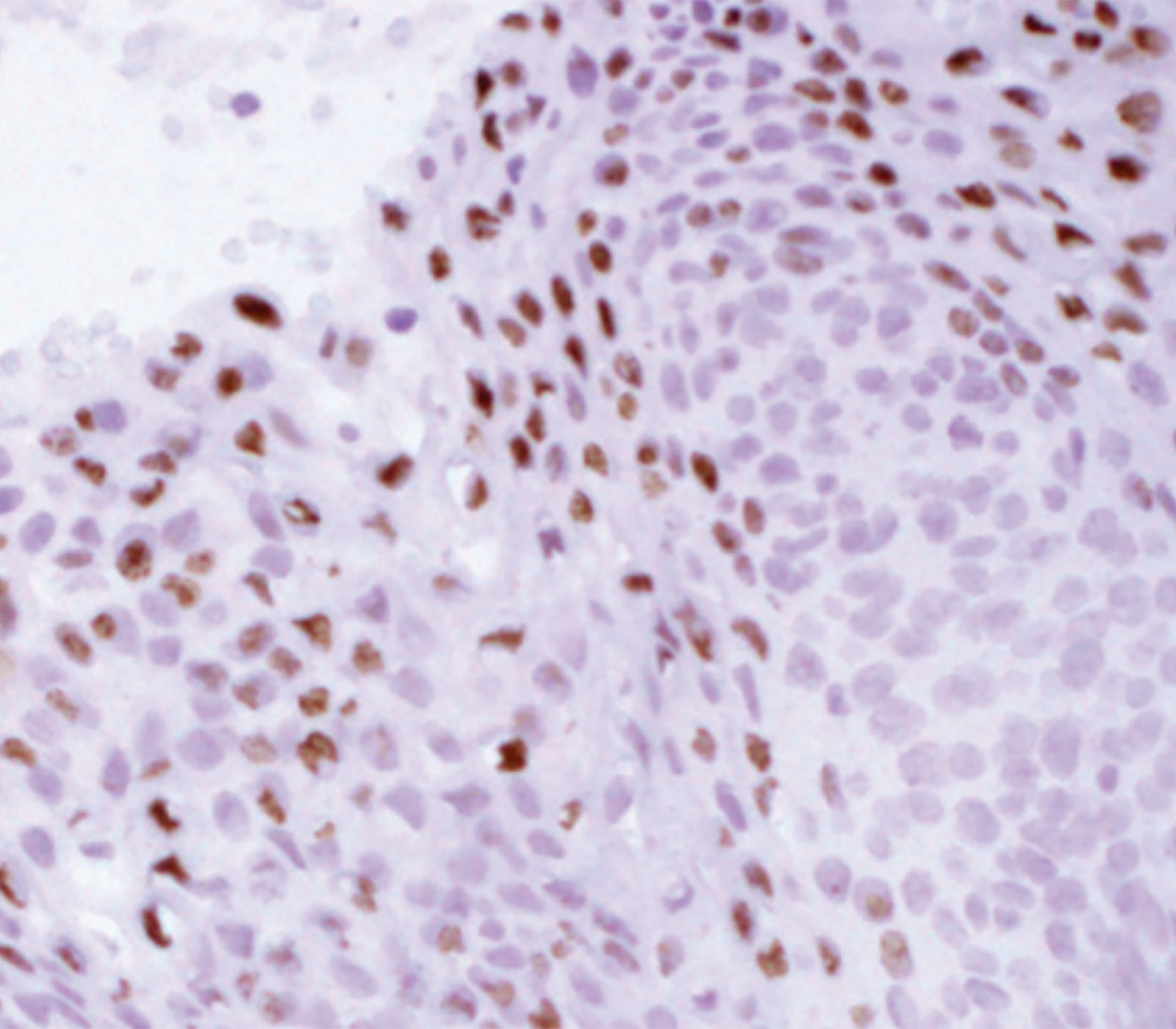 PATHO-GENE® & DIGX® HPV Probes - Enzo