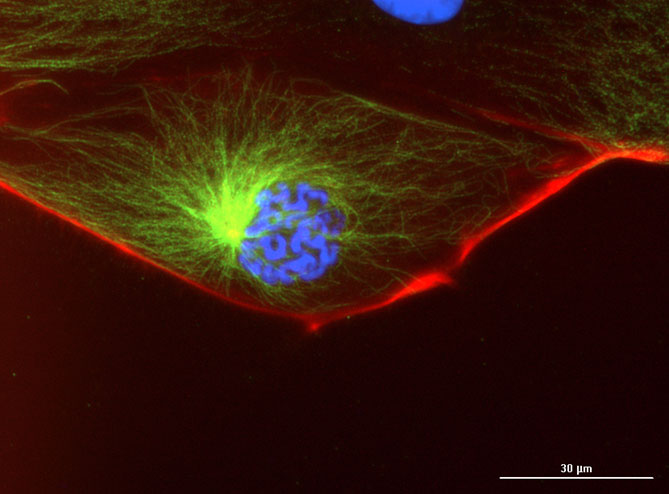 10 Tips for High Quality Images by Cellular Microscopy - Enzo