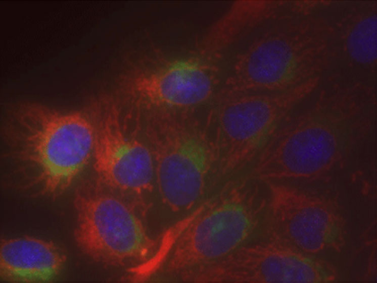 Basic Research - Enzo