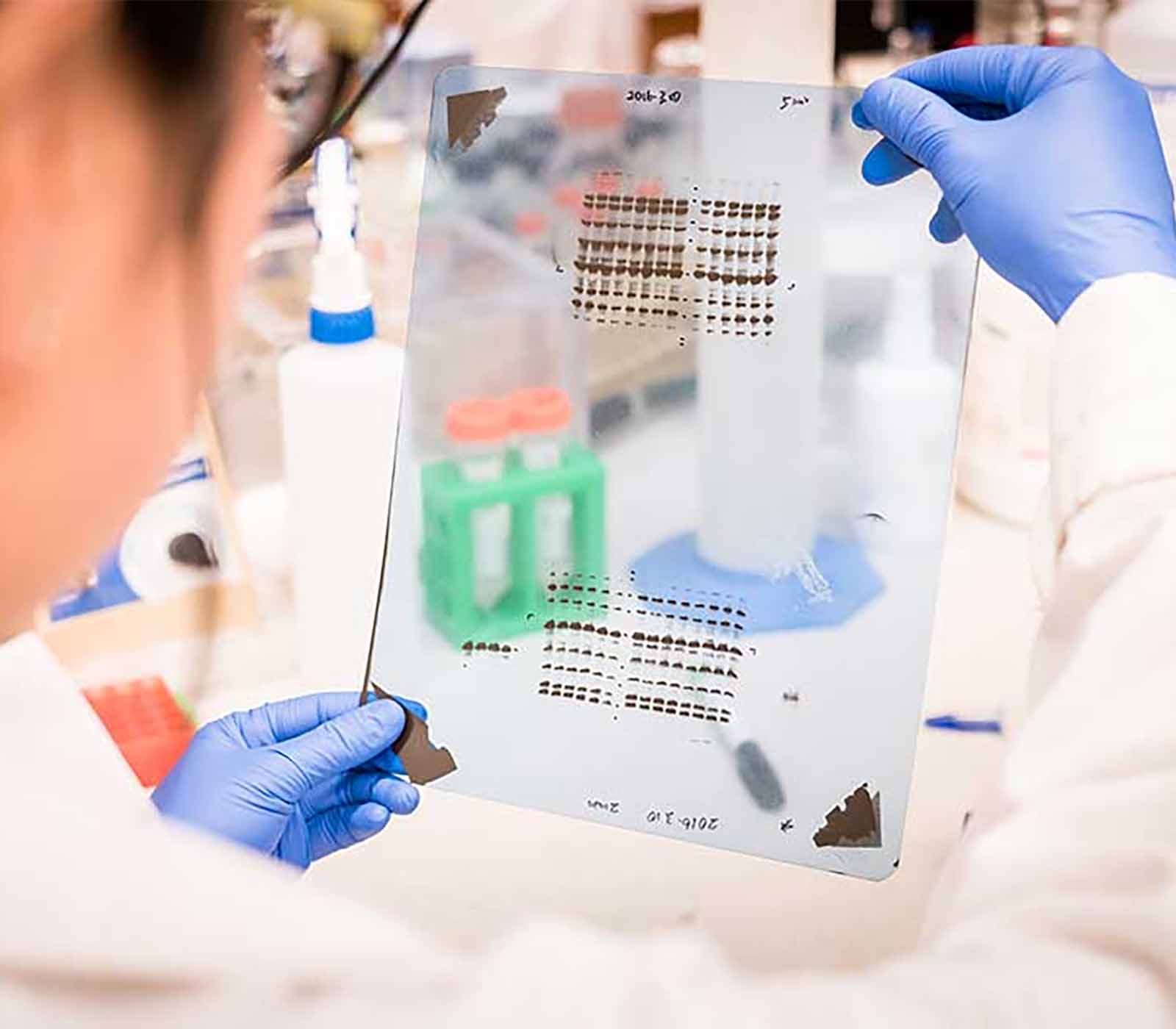 How do you Choose the Right Western Blot Detection Method? - Enzo