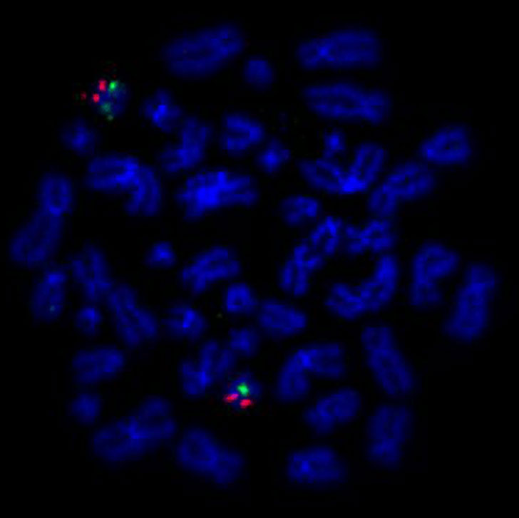 What are the Pros and Cons of FISH, aCGH and NGS? - Enzo