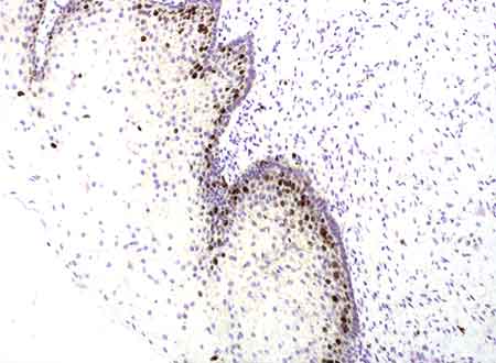 What are the differences between IHC and ISH and how do they help in ...