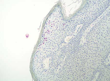 What are the differences between IHC and ISH and how do they help in ...