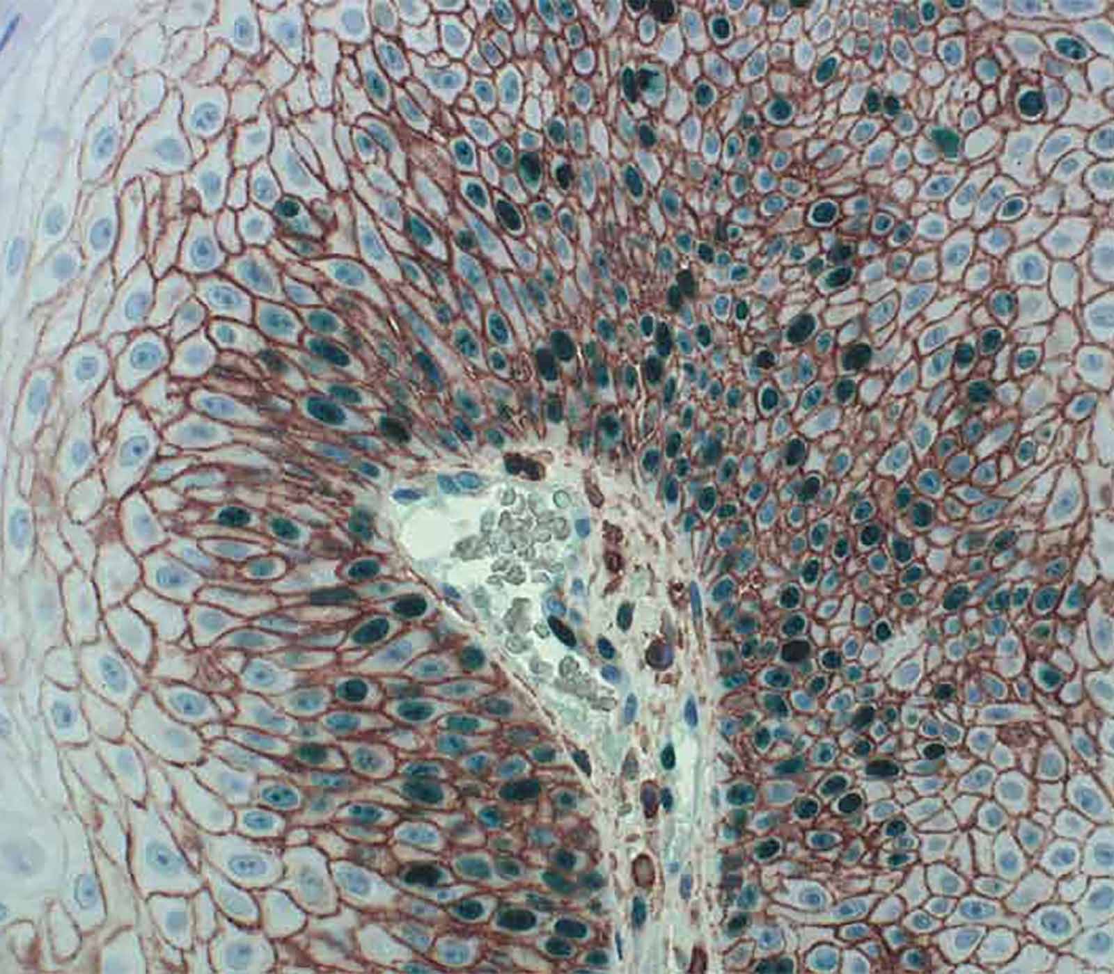 What are the differences between IHC and ISH and how do they help in ...