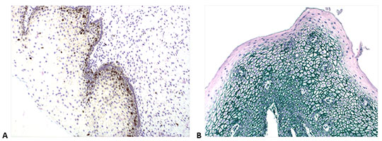 What are the different detection methods for IHC? - Enzo