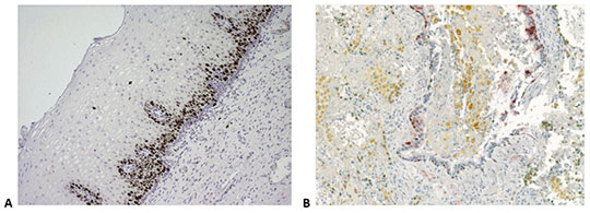 What are the different detection methods for IHC? - Enzo
