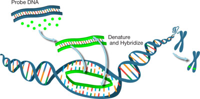 FISH Testing in Cancer - Enzo