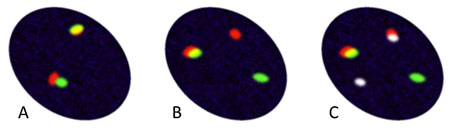 FISH Testing in Cancer - Enzo