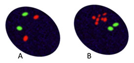 FISH Testing in Cancer - Enzo