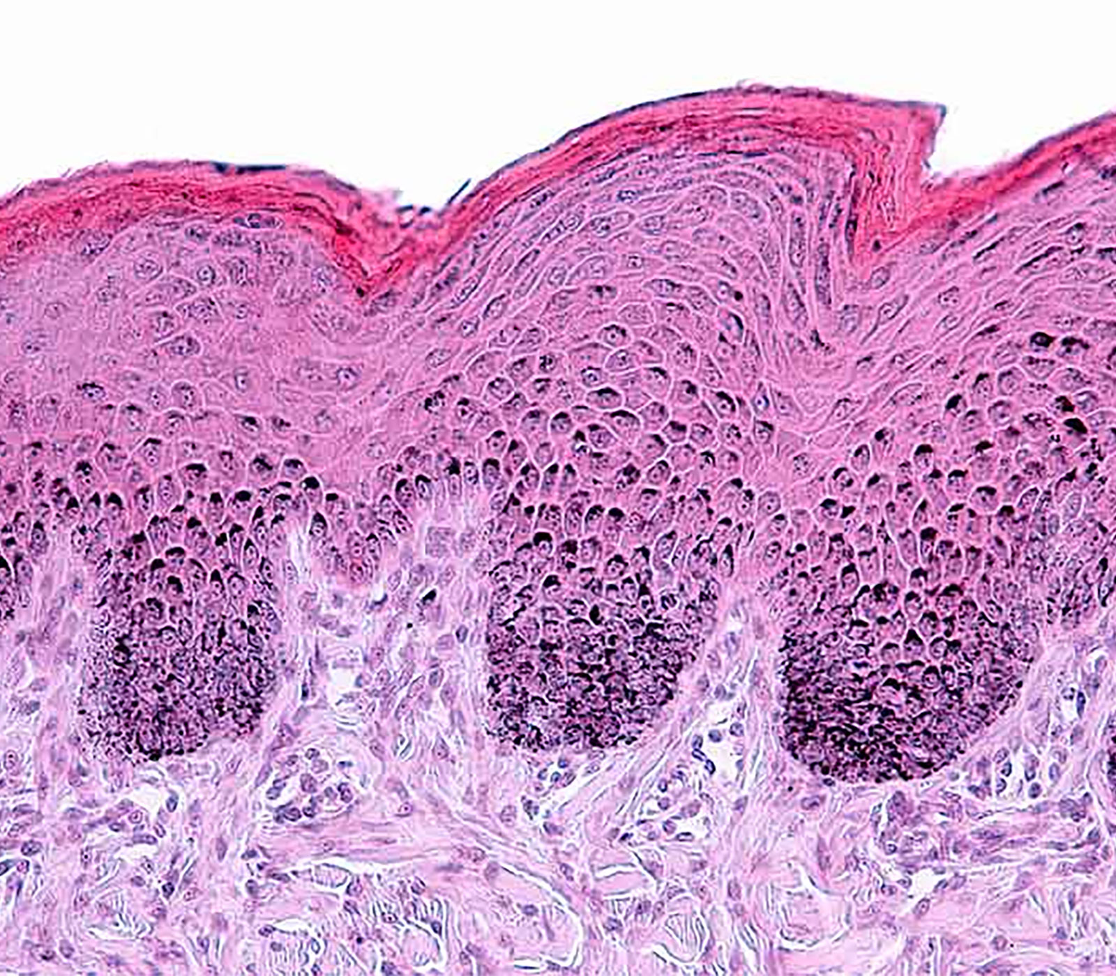 IHC Counterstains for Enzyme/Chromogen and Fluorescent Immunostaining ...