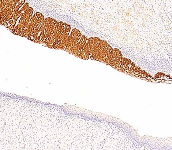 IHC Counterstains for Enzyme/Chromogen and Fluorescent Immunostaining ...