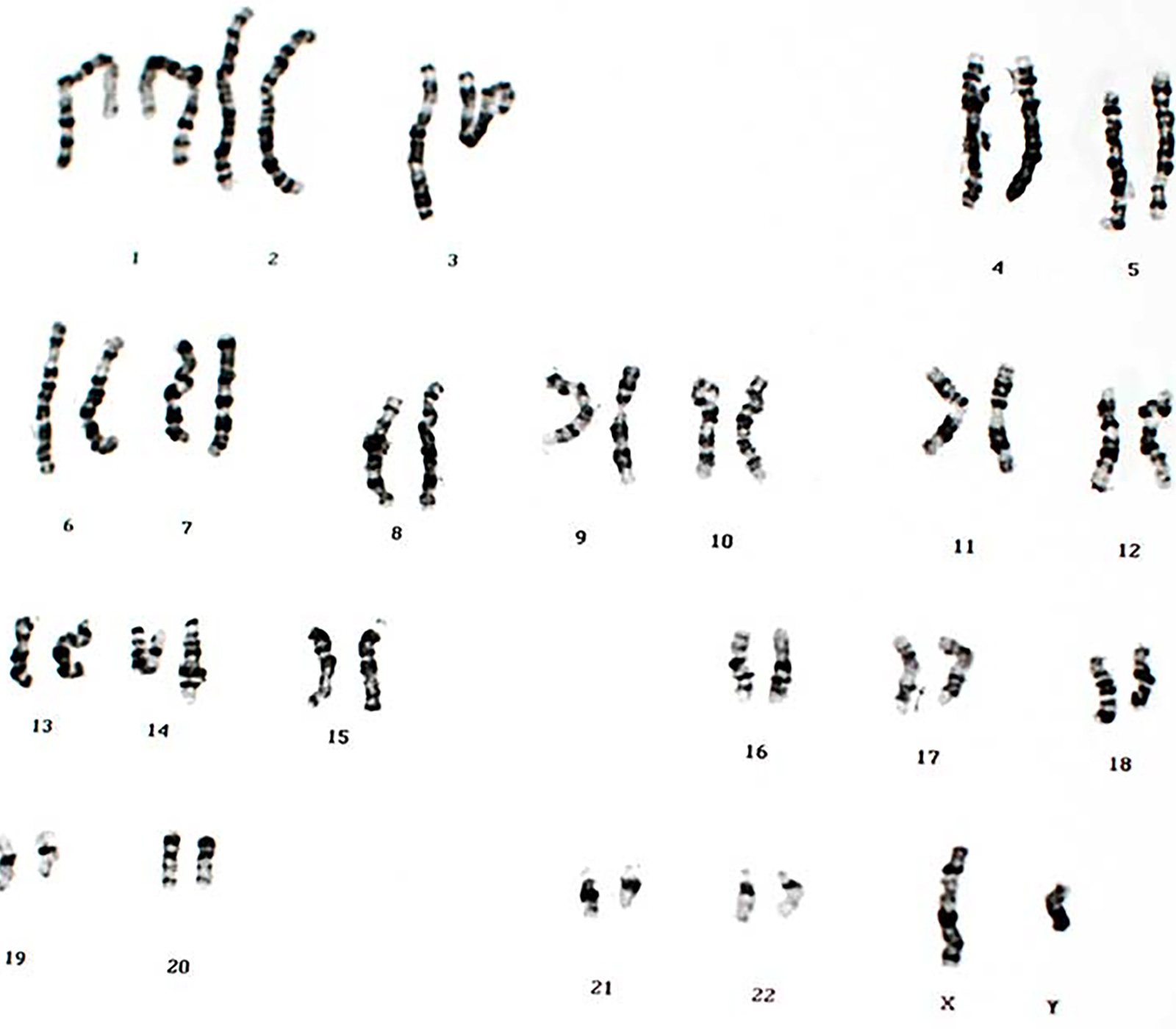 How to Choose the Right Cytogenetics Technique for Your Research? - Enzo