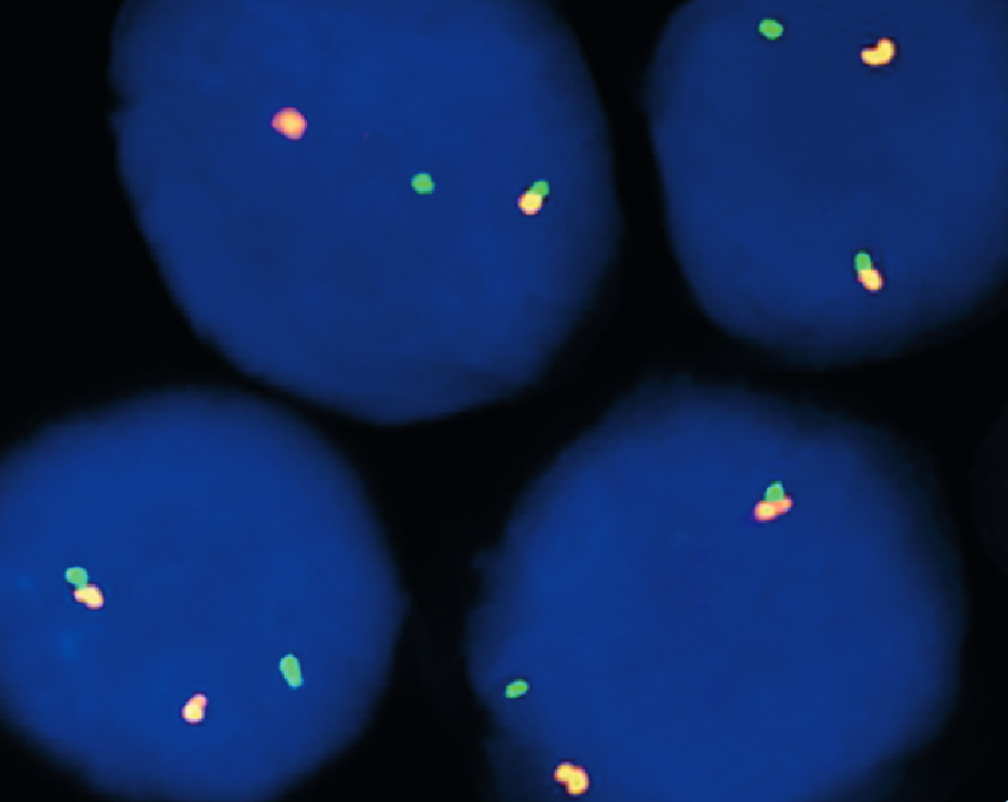 ZytoVision FISH Probes - Enzo