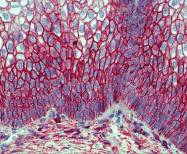 Immunohistochemistry Detection Reagents - Enzo