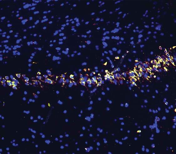 What are the differences between IHC and ISH and how do they help in ...