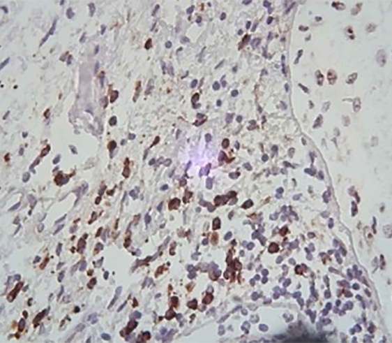 What are the differences between IHC and ISH and how do they help in ...