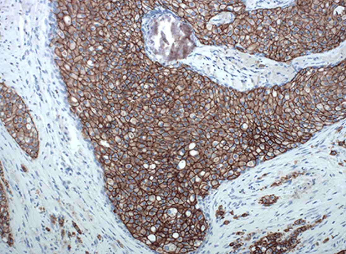 Protein Detection - Enzo