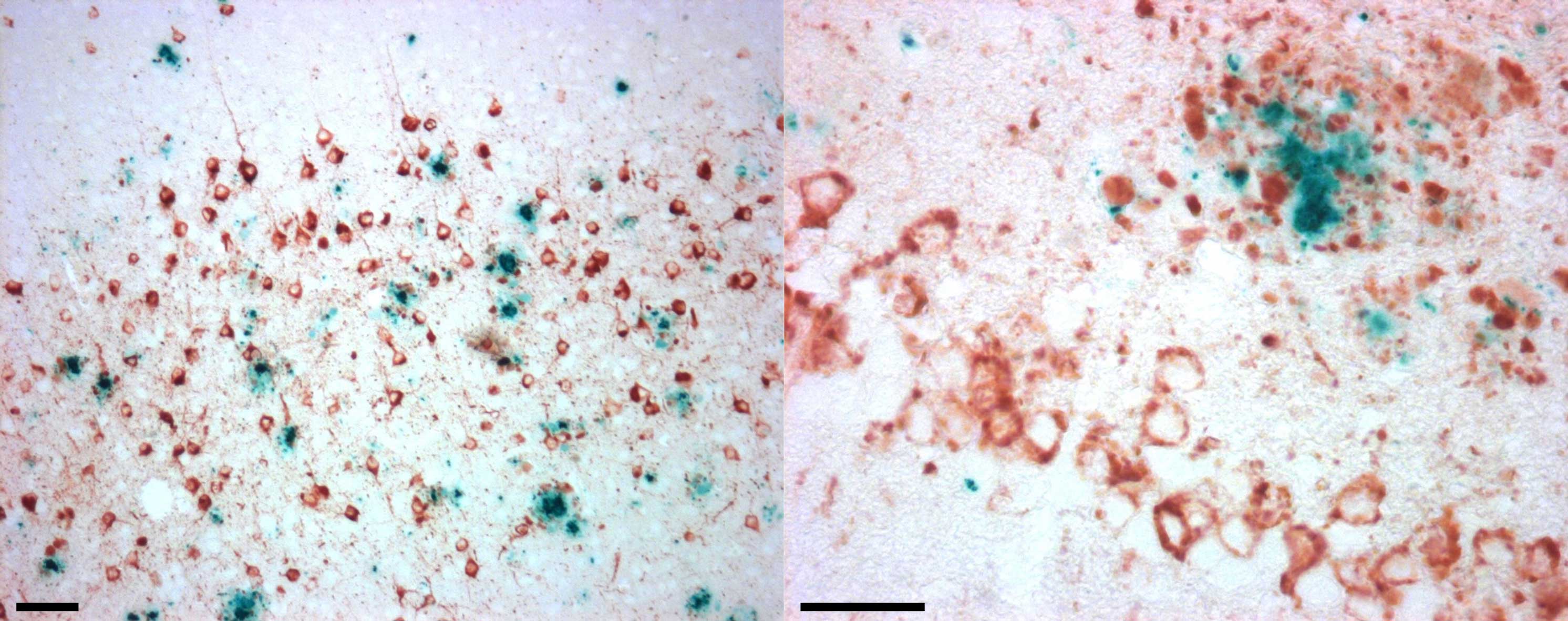 Protein Detection - Enzo
