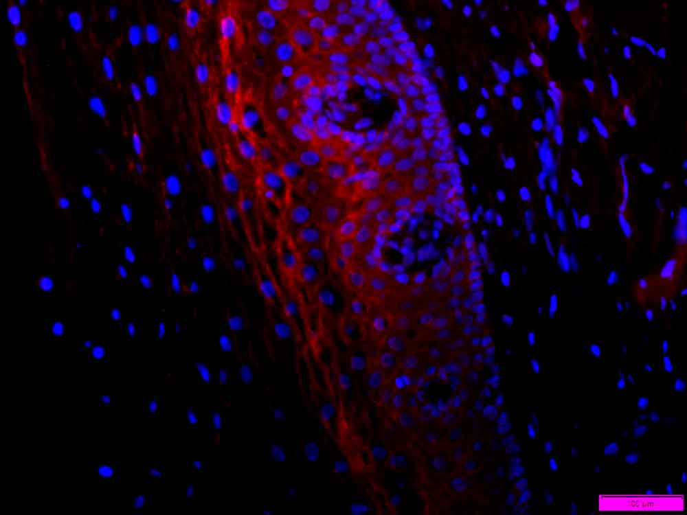 Protein Detection - Enzo