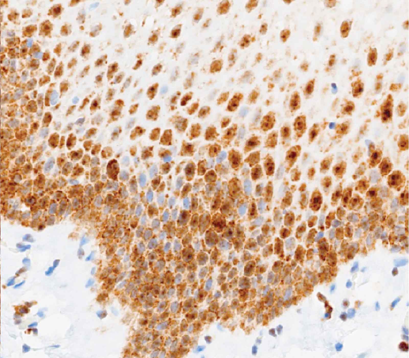 Enzo announces collaboration with Roche Diagnostics France for the ...