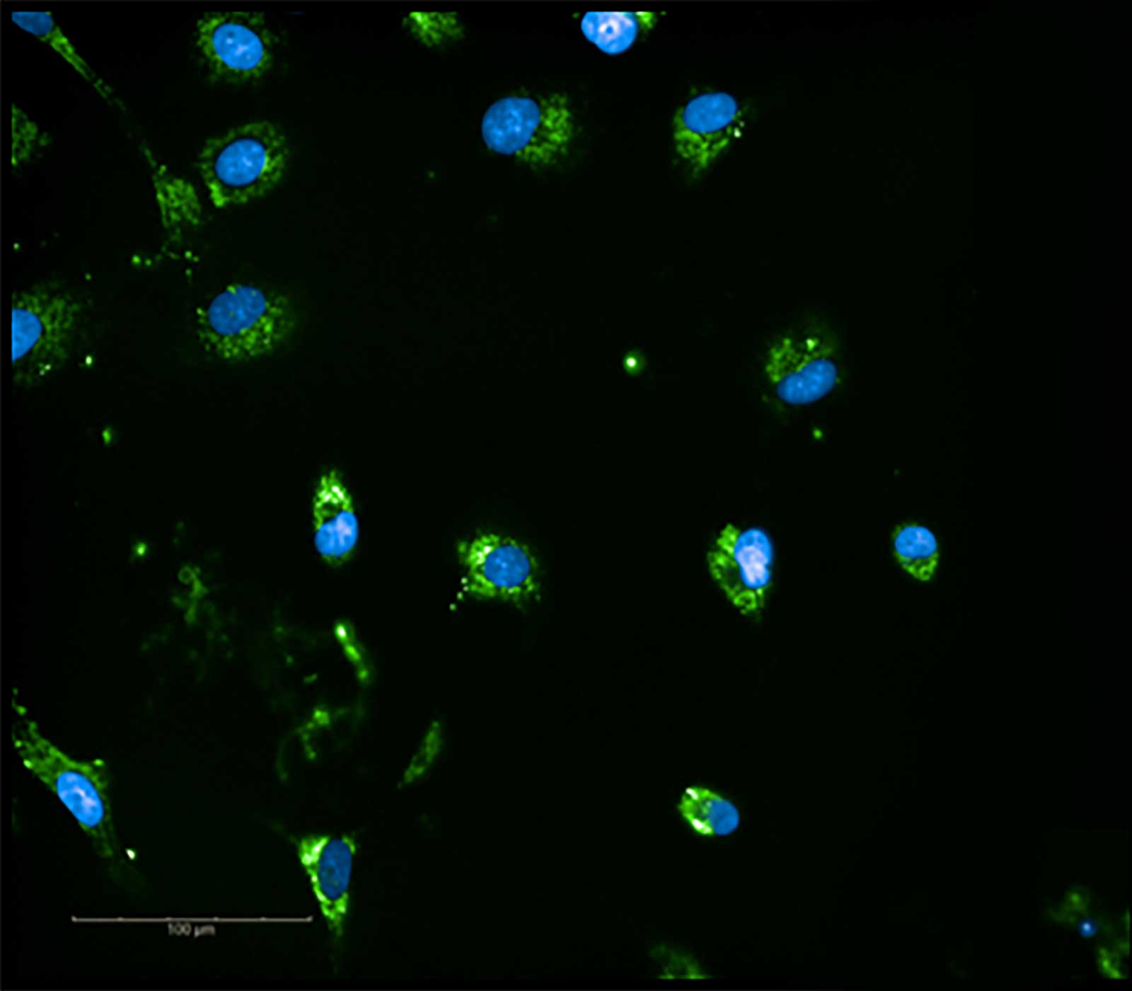 Annexin V-FITC Apoptosis Detection Kit validated via the Incucyte S3 ...